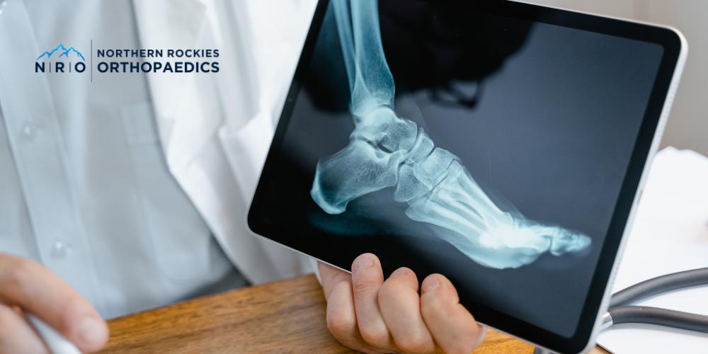 Foot and Ankle Conditions in Missoula, Montana | NRO