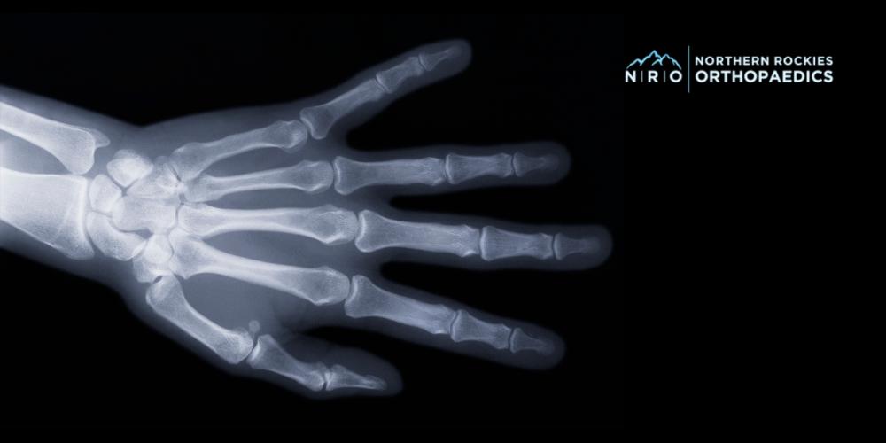 Wrist and Hand Treatments in Missoula, Montana | NRO